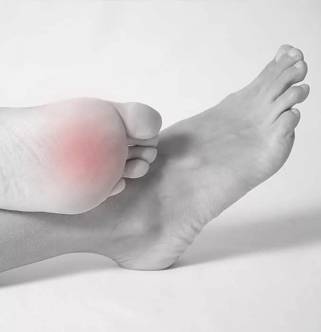 Ball of Foot Pain (Metatarsalgia) - Footlogics